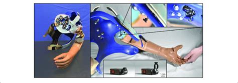Photographs Of The Closed Loop Nmi Prosthesis System Created For And