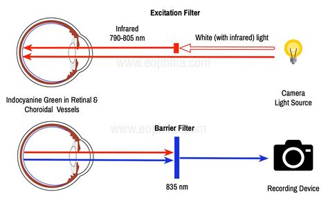 Fundus Fluorescein Angiography And Indocyanine Green Angiography Made Easy For The Postgraduates
