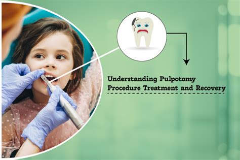 Understanding Pulpotomy Procedure Treatment And Recovery