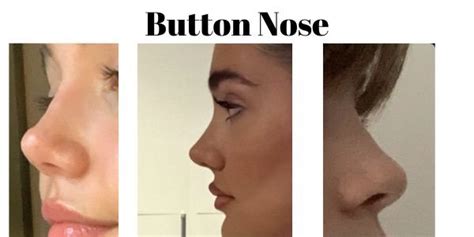 Hawk Nose Comparison With Other Types Of Noses