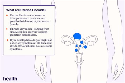 Uterine Fibroid Symptoms And Signs Fibroids 101 What Are Fibroids
