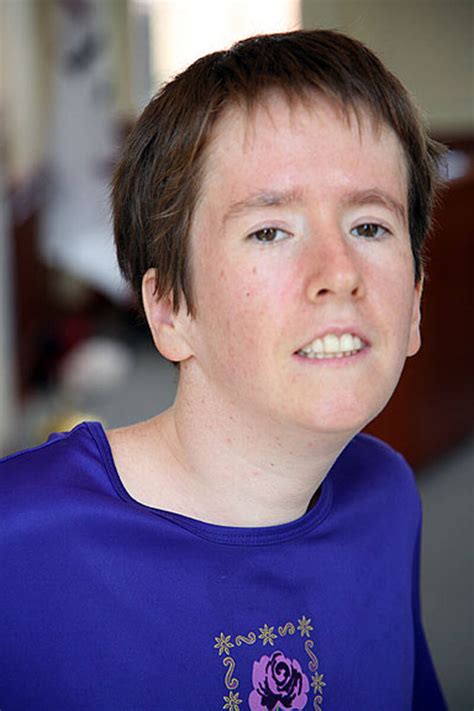 Prader Willi Syndrome Positive Exposure