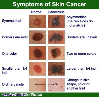 Cancer Symptoms Skin Symptoms Cancer