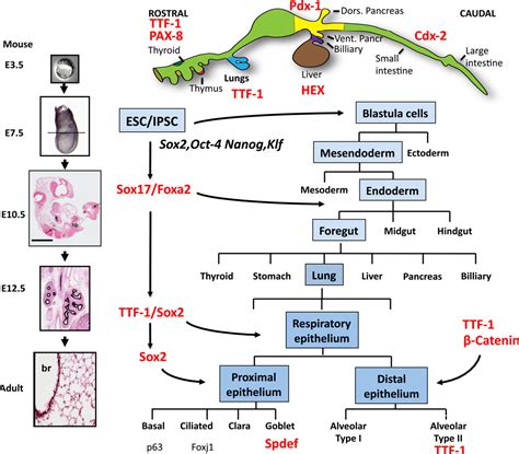 Figure From Pulmonary Perspective Intersections Between Pulmonary Development And Disease