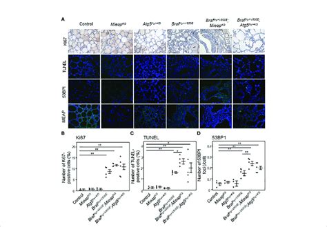 Ihc Staining For Ki67 Tunel 53bp1 And Mieap Expression A And