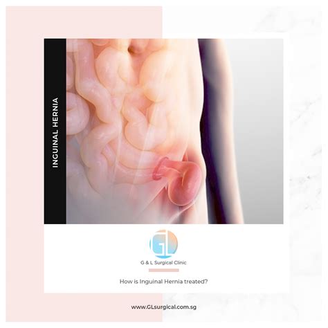 how is inguinal hernia treated g and l surgical clinic