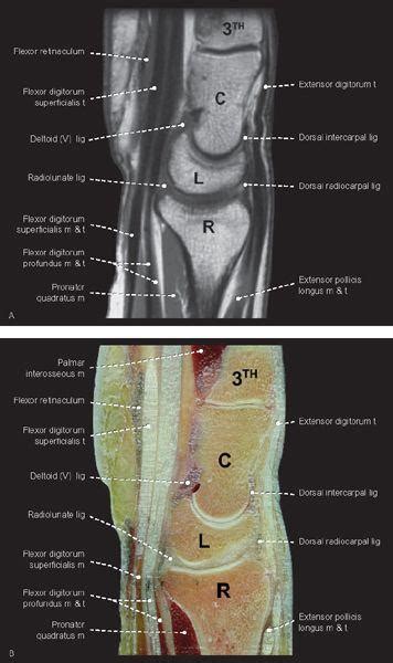Technical Considerations For Mri Of Upper Extremity Joints Radiology Key