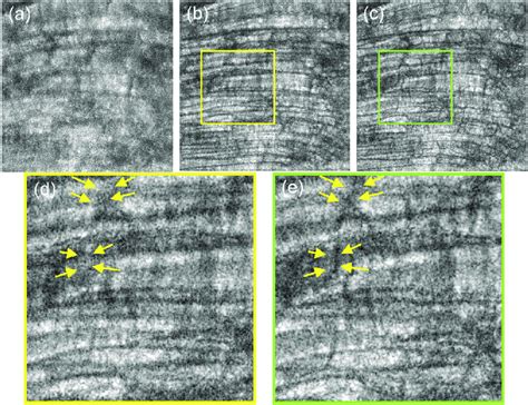 Examples Of Computational Refocusing Of En Face Chicken Breast Muscle