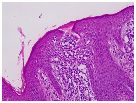 Life Special Issue Current Research On Dermatology Pathology