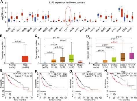 Expression And Prognostic Role Of E2f2 In Hepatocellular Carcinoma Pmc