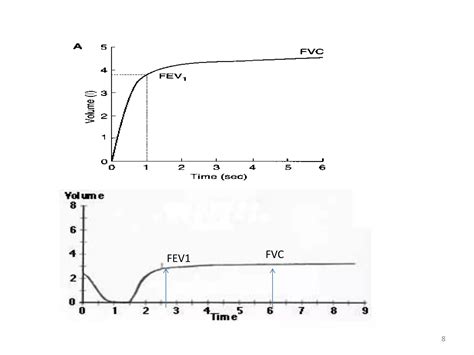 Pft Interpretation Pptx Lung And Respiratory Health Diseases And