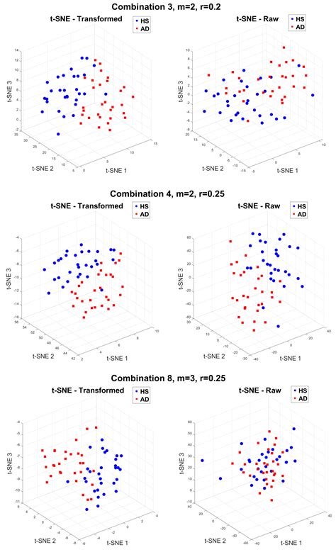 Improving Multiscale Fuzzy Entropy Robustness In Eeg Based Alzheimers Disease Detection Via