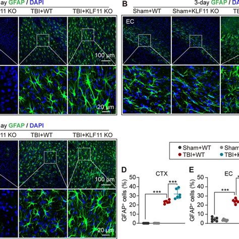Klf11 Genetic Deficiency Promotes Astrocytic Activation In The White