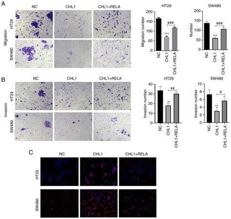 Chl1 Inhibits Cell Proliferation Migration And Invasion By Regulating The Nf‑κb Signaling