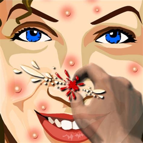 Pimple Breakout By Debbie Castillo