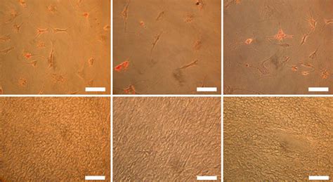 Differentiation Potential Of Ascs The Pictures Show Oil Red O Staining