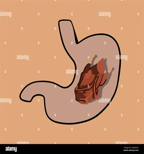 Vector Isolated Illustration Of Meat Digestion Overeating On Holidays Turkey Digestion