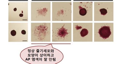 대사물질 통해 줄기세포 분화 초기단계 규명 난치병 치료 기대