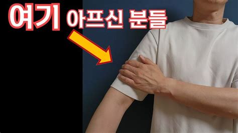 팔 통증 상완부 통증의 원인은 팔이 아닙니다 Feat 어깨통증