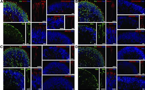 Photoreceptor Characterisation In Hescs Derived Retinal Organoid At Day Download Scientific