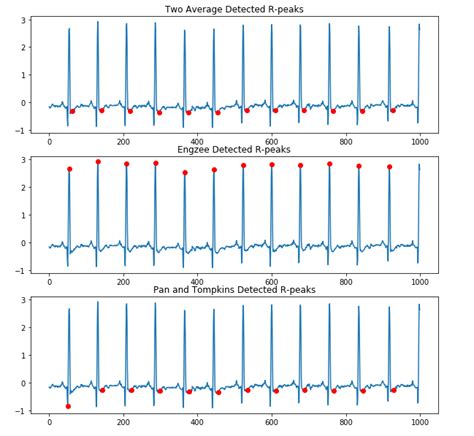 Incorrect R Peak Detection Issue Luishowell Ecg Detectors GitHub
