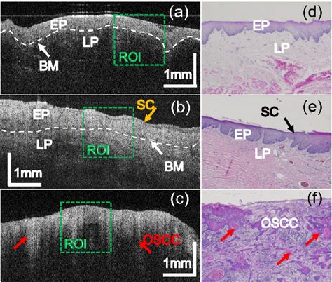 Figure 1 From Deep Learning Based Automated Identification And Visualization Of Oral Cancer In
