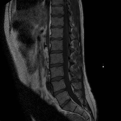Integration Of “segment Anything Model” Development 3d Slicer Community