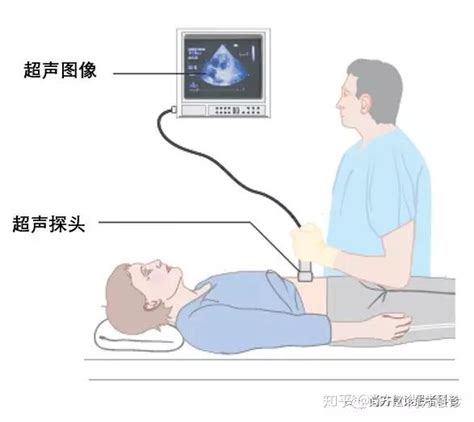 一文读懂超声检查及其在肿瘤诊断中的应用 知乎