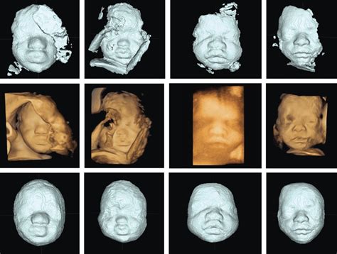 Examples Of The Segmentation Produced By The Automatic Algorithm Top