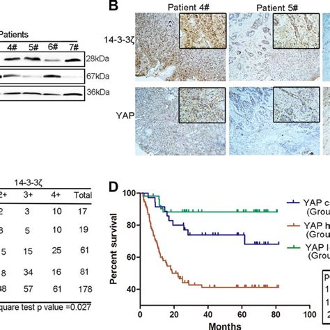 Correlation Between Clinicopathological Factors And Yap Ihc Staining In