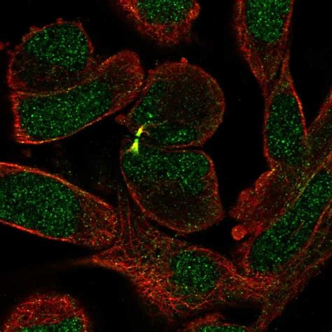 SETX Antibody PA