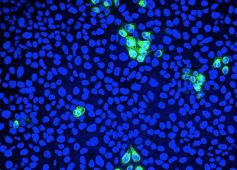 Herpes Zoster Virus Microscope