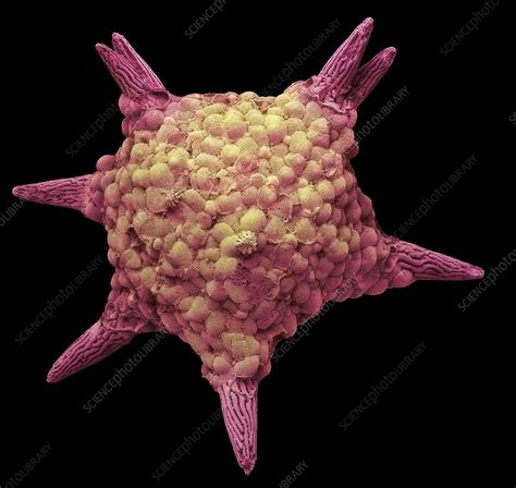 Foraminiferan Sem Stock Image C033 3330 Science Photo Library
