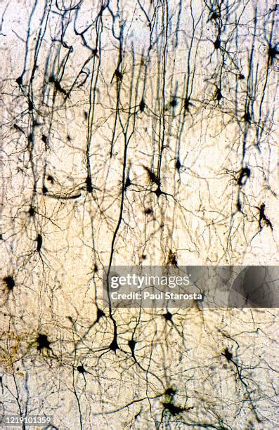 Rabbit Nervous System Photos And Premium High Res Pictures Getty Images
