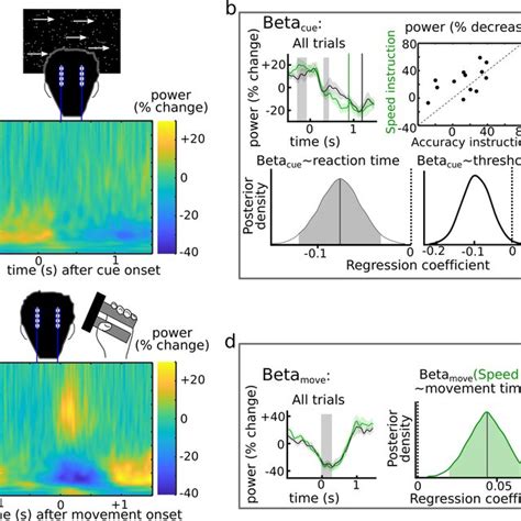 Local Field Potential Recordings From Subthalamic Nucleus A Grand