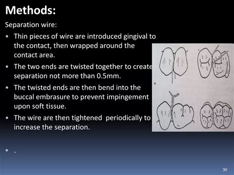 matrices retainers wedges and separators ppt dental health