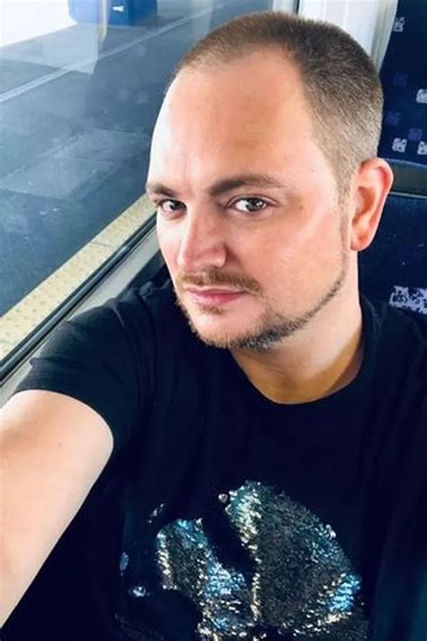 Blackpool Singers £16 000 Regret As He Warns Others About Botox And