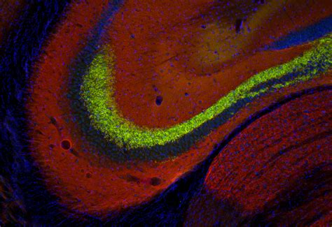 Synaptic Systems Vglut1