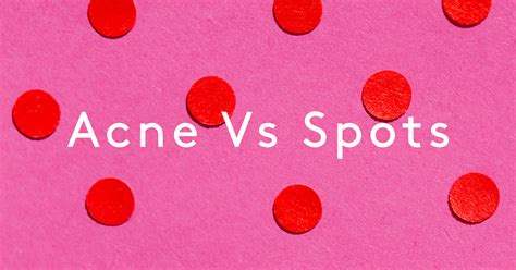 What Is Acne How Is It Different To Spots