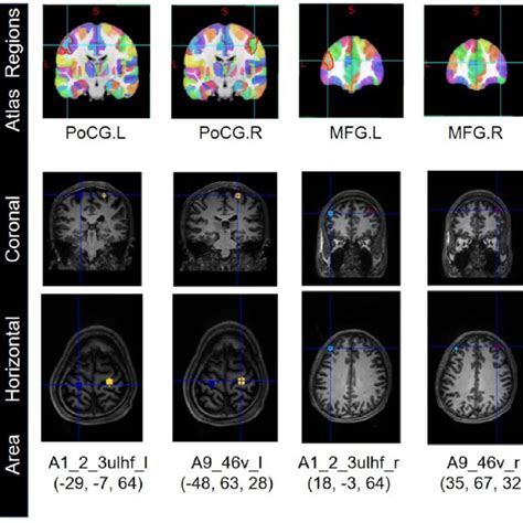 The Selected Four Seed Nodes Correspond To The Brainnetome Atlassub 1
