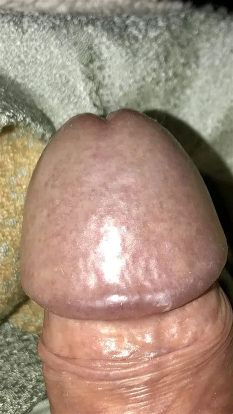 Big Cock Head 22 Nude Pics Xhamster