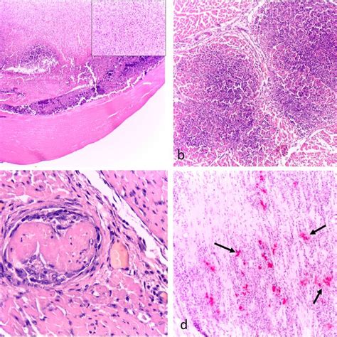Microscopic Cardiac Lesions A Myocardium And Valvular Endocardium Download Scientific Diagram
