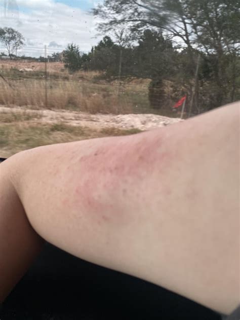 Reaction To My Omnipods I Will Attach An Explanation In The Comments