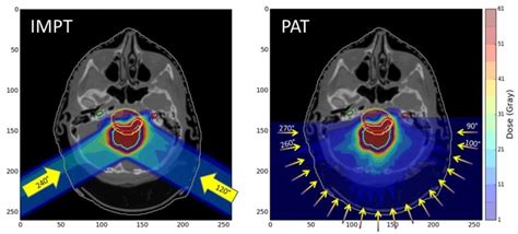 Proton Arc Therapy The Next Evolution In Proton Delivery Physics World
