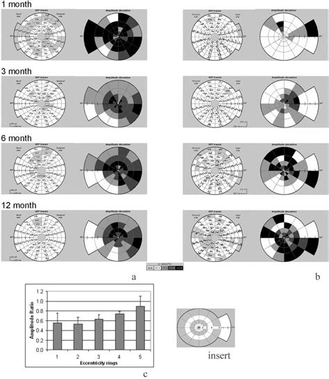 A Examples Of Mfvep Trace Arrays And Amplitude Deviation Plots