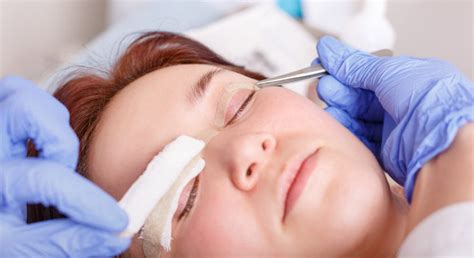 Blepharoplasty Basics How Eyelid Surgery Works Slmd Skincare By