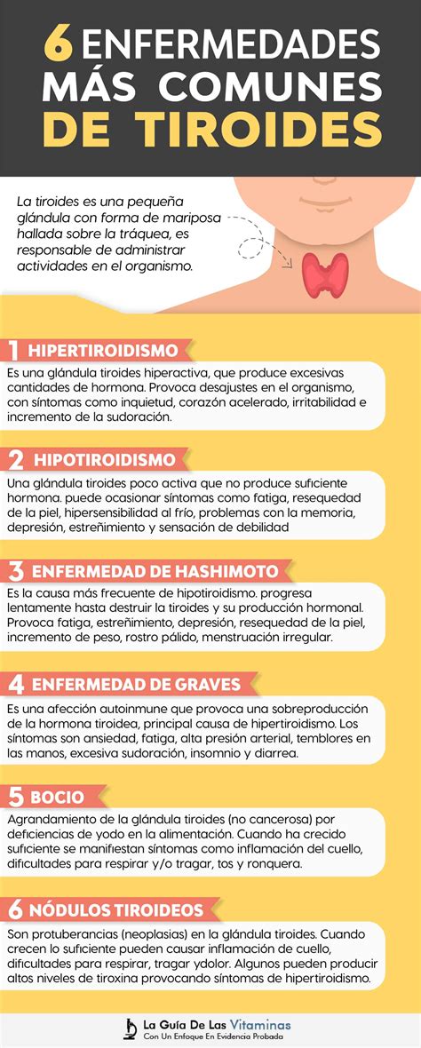 Qué Es La Enfermedad De La Tiroides Y Cuáles Son Sus Síntomas Czckyq