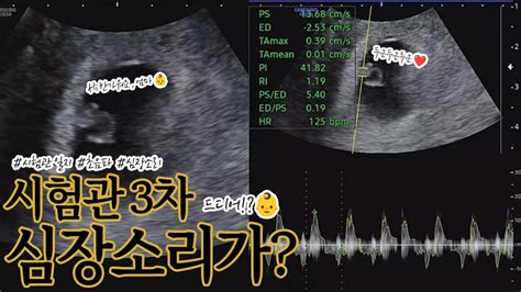 시험관 Vlog 과연 심장소리 들을 수 있을까 자궁경부암 검사하고 김해 여행가는 일상 Youtube