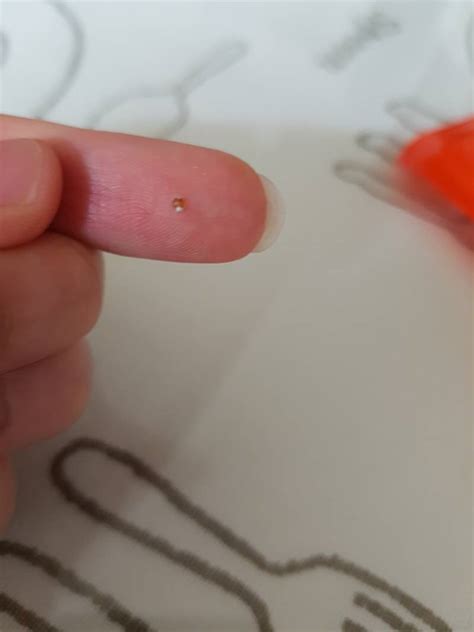 가슴 밑에서 나온 피지 인스티즈instiz 일상 카테고리