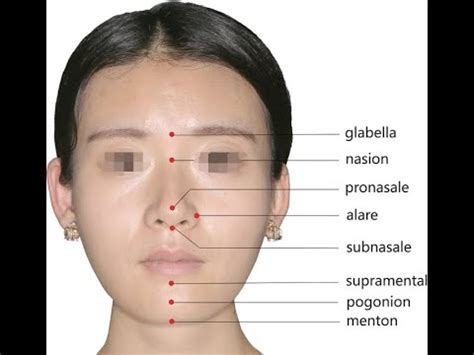 Anatomy Of The Nasion Bridge Of The Nose Youtube
